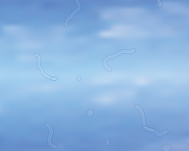 Flashes and Floaters | The Eye Institute of West Florida