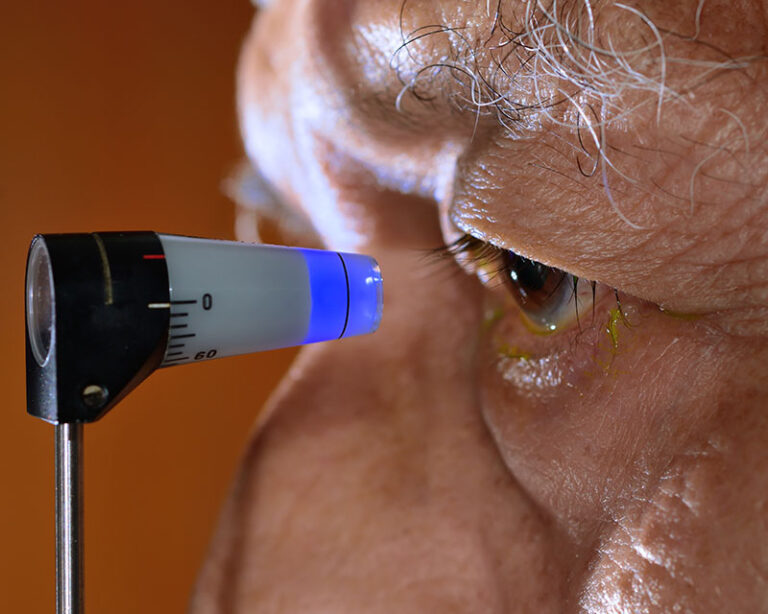 Selective Laser Trabeculoplasty in West Florida | The Eye Institute of ...